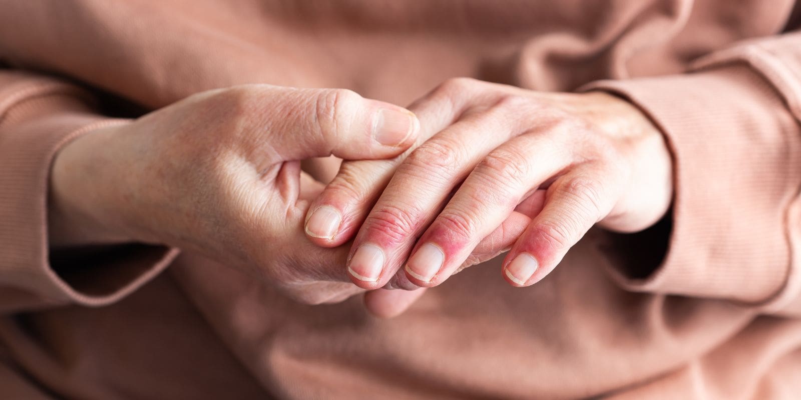 3 Problemas más frecuentes de las manos | Cero Residuo - Tienda Online ...